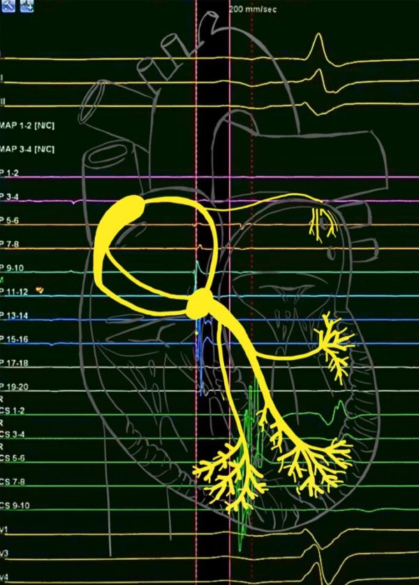 EP in Practice - Product Overview - Cardiac Physiology in Practice